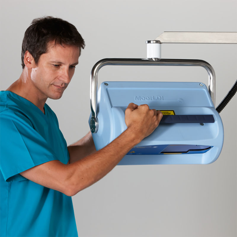 Thiết bị đánh giá độ nông sâu vết thương bỏng MoorLDI-2 - HDGMEDHDGMED